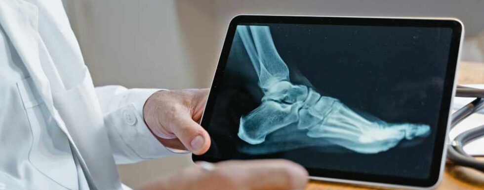🦴 Strong Bones, Big Energy: Why Your Skeleton Isn’t as “Fragile” as You ...
